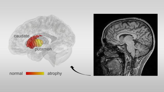 "MRI" รวมข่าวเกี่ยวกับ "MRI" เรื่องราวของ"MRI"
