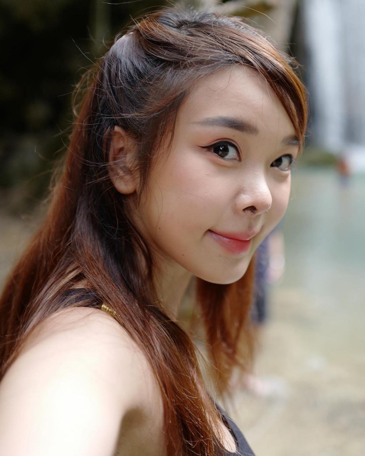 หญิงแย้ ได้บทเรียนจากการทำศัลยกรรม จมูกติดเชื้อต้องผ่าตัดรอบที่ 3