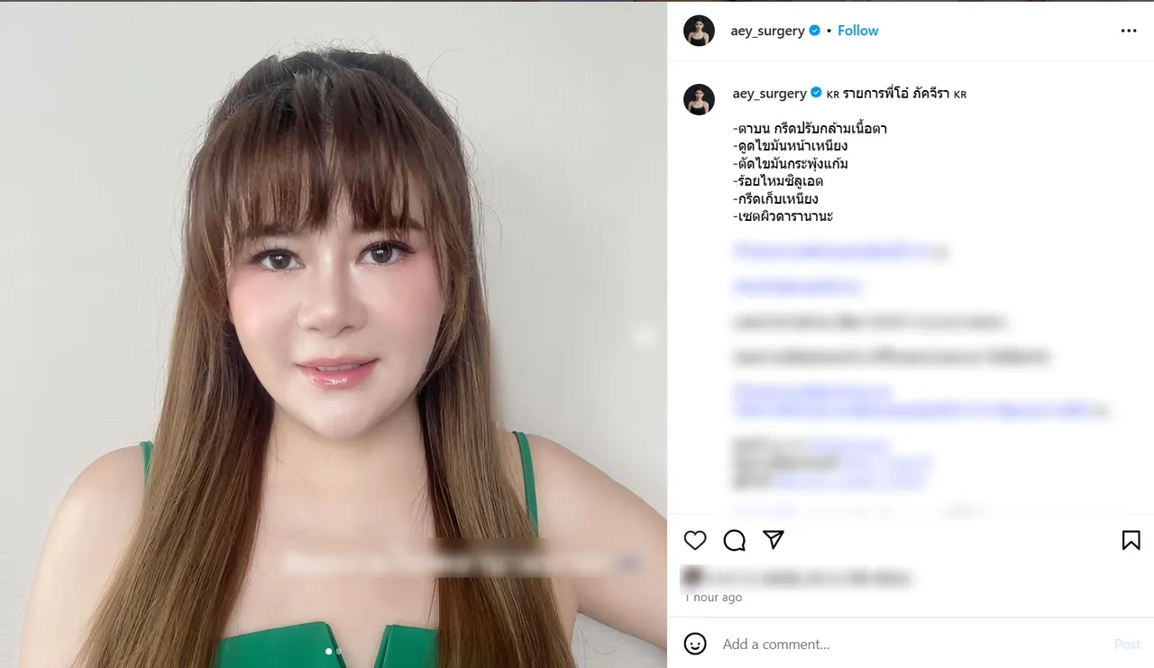 โอ๋ ภัคจีรา โพสต์รีวิวพลีชีพ เทียบภาพชัดๆ ก่อนและหลังศัลยกรรมวัย 48 ปี | SootinClaimon.Com